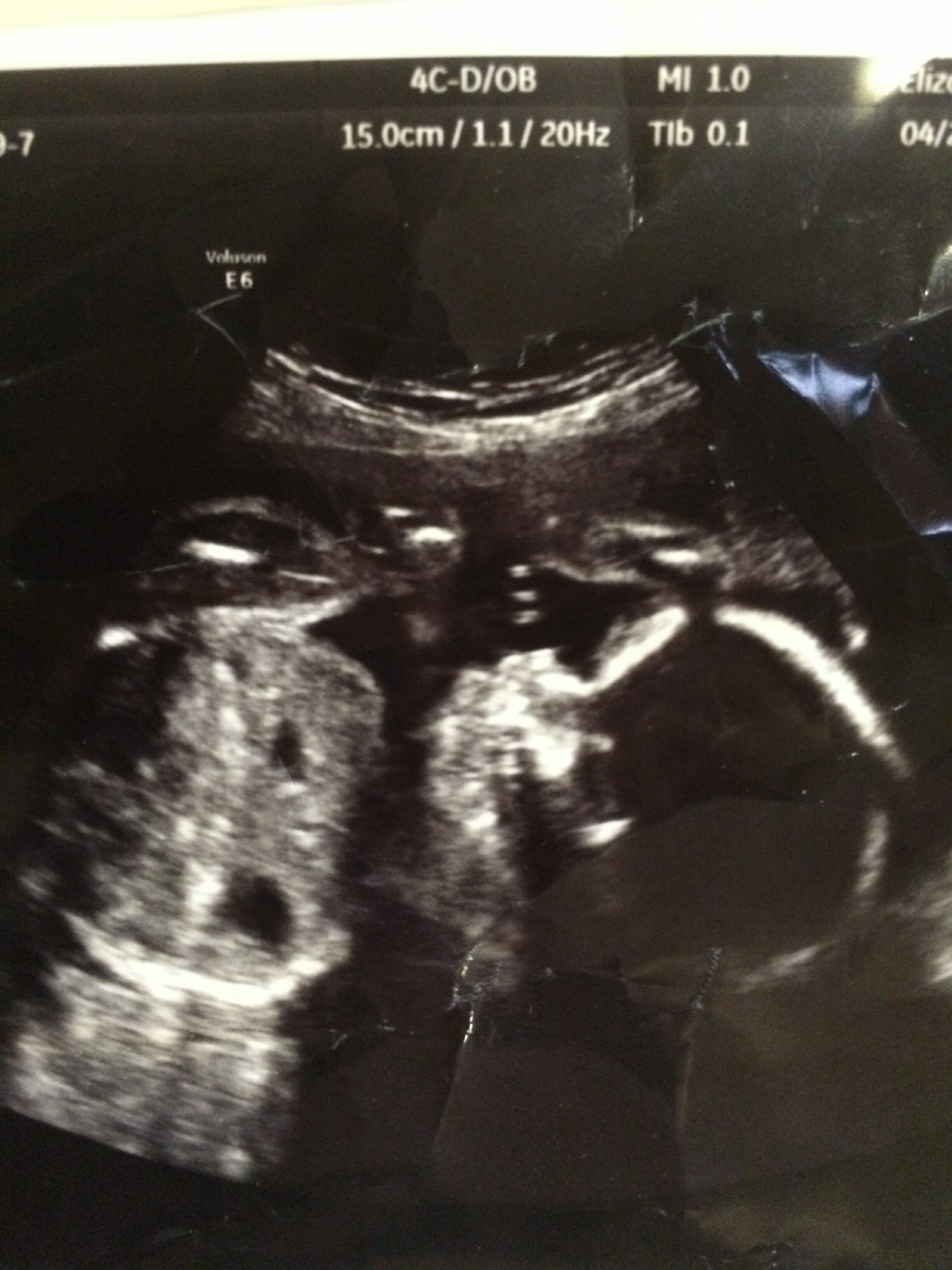 Quick 25 Week Pregnancy Update: Baby #3 - Mama on the Homestead